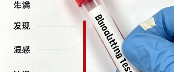 Coagulogram: norm and interpretation of the indicators of this blood test
